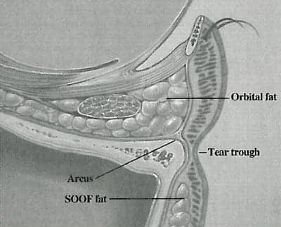 The Eyes Have It - Plastic Surgery Practice