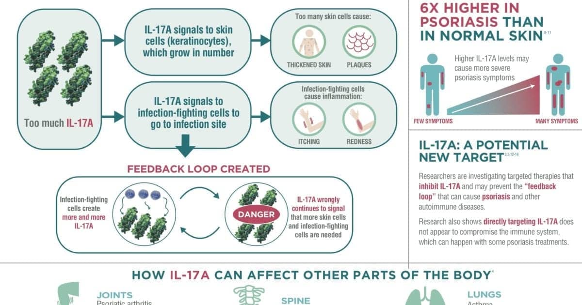FDA Approves Novartis' New IL-17A-Blocking Psoriasis Drug Cosentyx ...