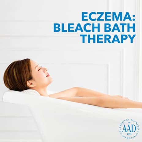 How to Use Bleach Baths to Help Manage Eczema Flares - Plastic Surgery ...